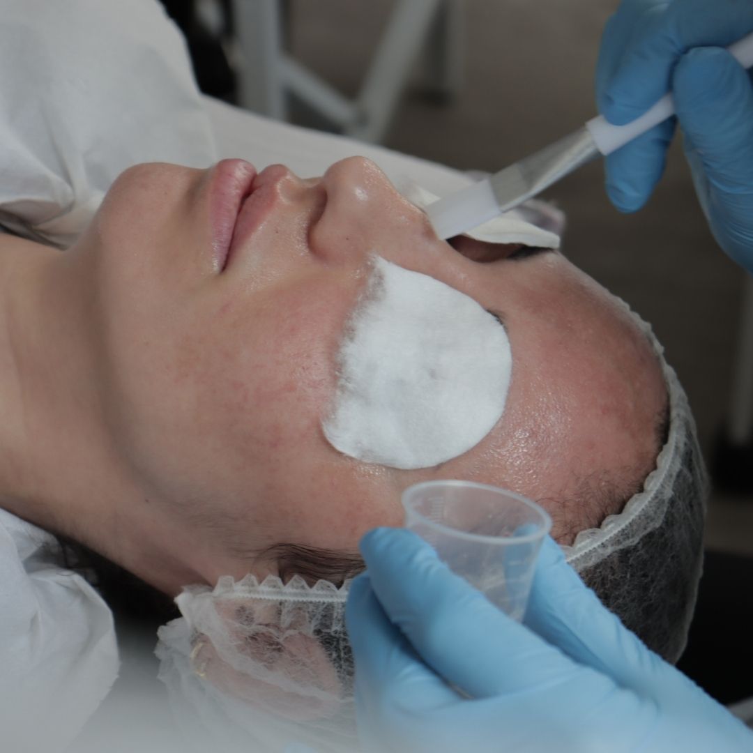 Chemical Peel Course London | Level 4 & 5